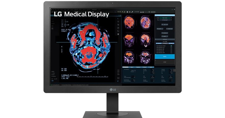 LG expands medical digital signage with 2MP IPS Diagnostic Monitor ...