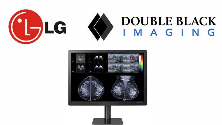 LG makes inroads in medical imaging with DBI partnership | Digital ...