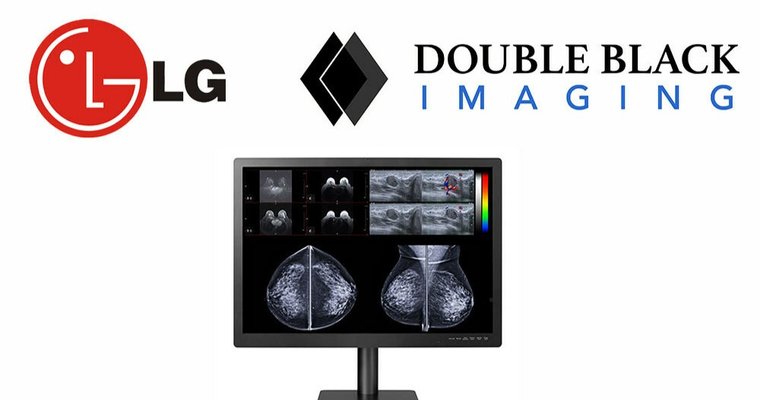LG makes inroads in medical imaging with DBI partnership | Digital Signage Today